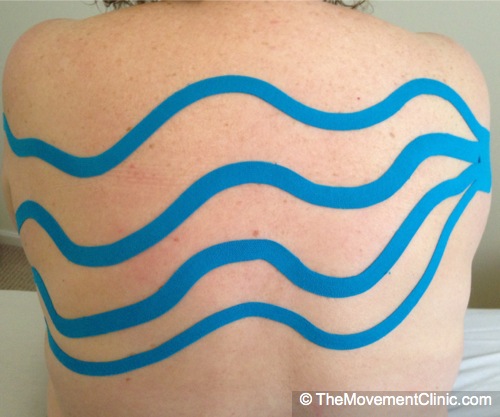 back_taping_1 - The Movement Clinic | The Movement Clinic
