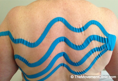 back_taping_2 - The Movement Clinic | The Movement Clinic
